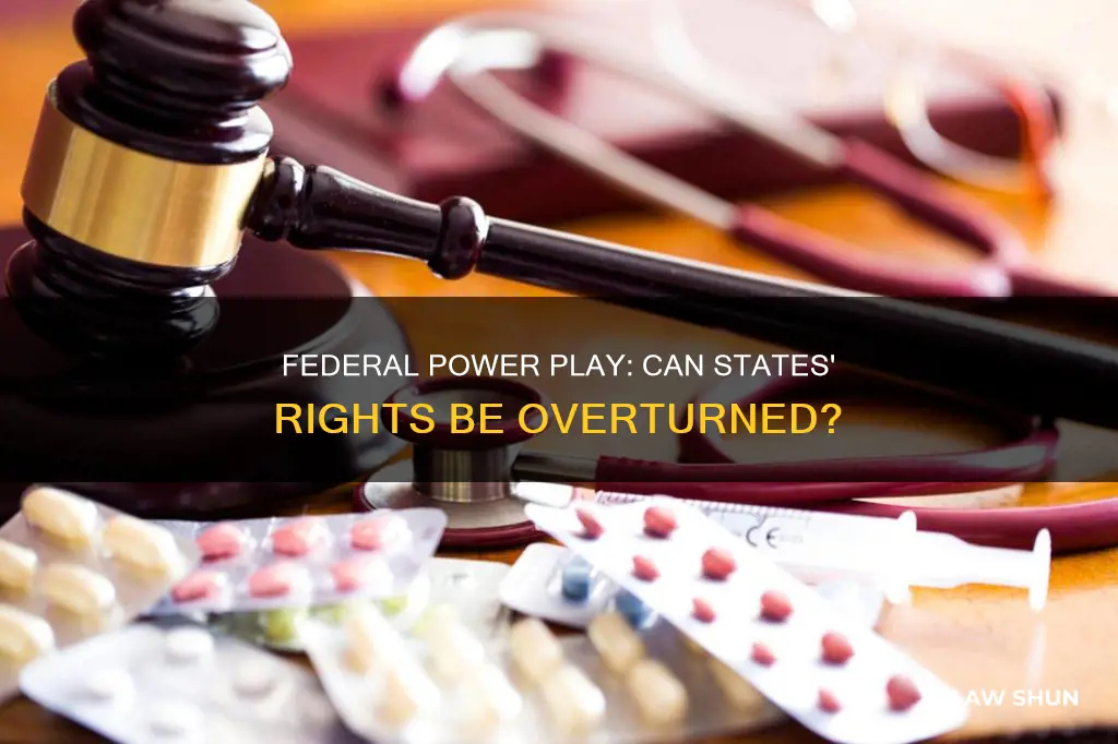 Federal Power Play: Can States' Rights Be Overturned? | LawShun