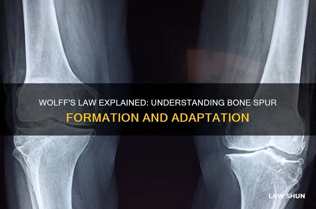 Wolff's Law Explained: Understanding Bone Spur Formation And Adaptation ...