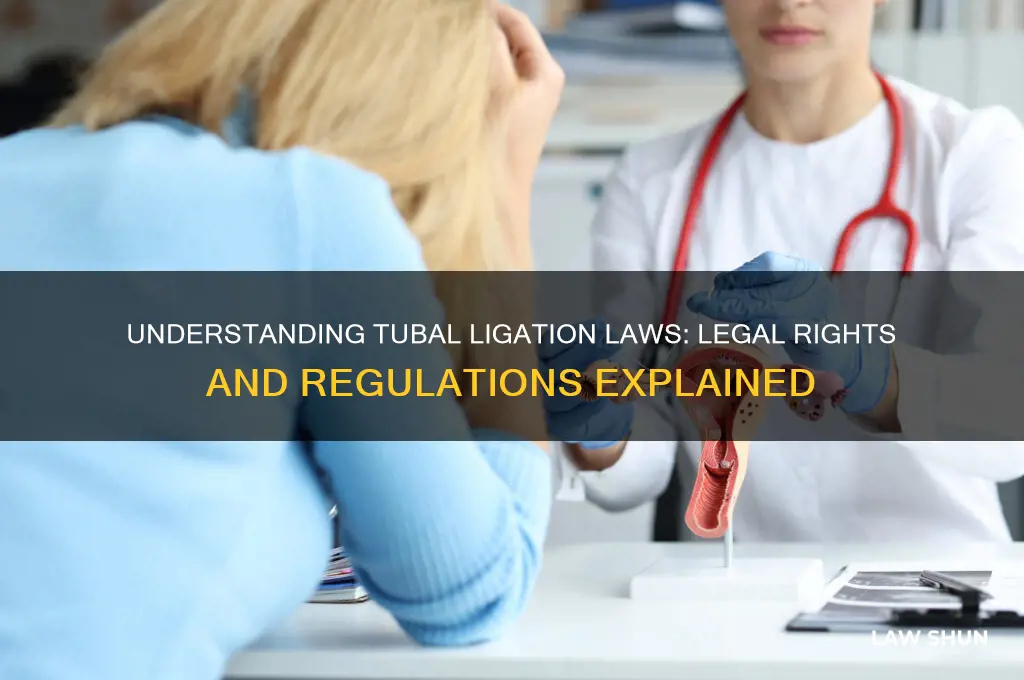 Understanding Tubal Ligation Laws: Legal Rights And Regulations ...
