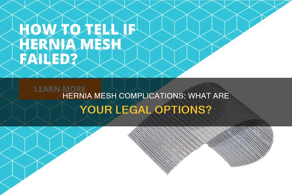 Hernia Mesh Complications: What Are Your Legal Options? | LawShun