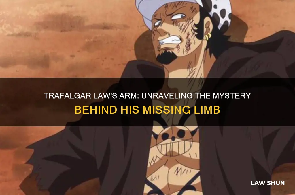 Trafalgar Law's Arm: Unraveling The Mystery Behind His Missing Limb ...