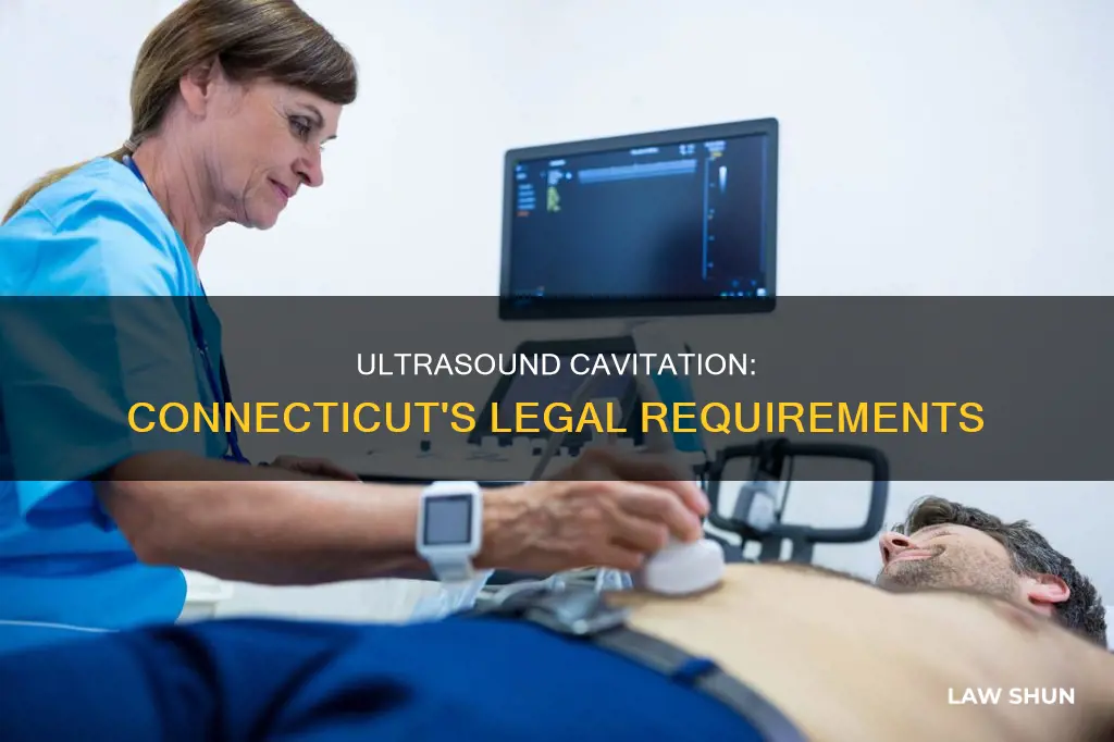 Ultrasound Cavitation: Connecticut's Legal Requirements | LawShun